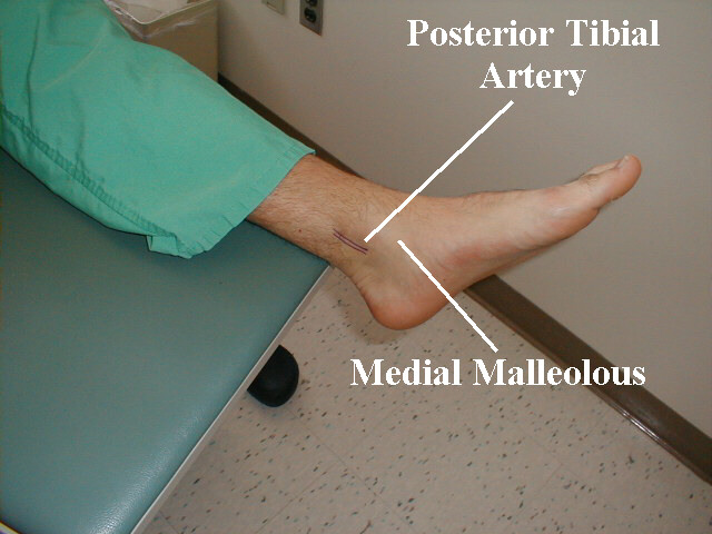 Understanding the Importance of the Posterior Tibial Pulse for Good ...